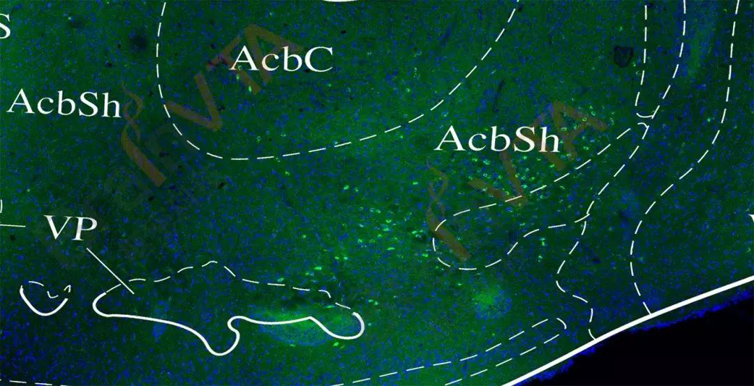 霍乱毒素B亚基（CTB）-产品武汉枢密脑科学技术有限公司