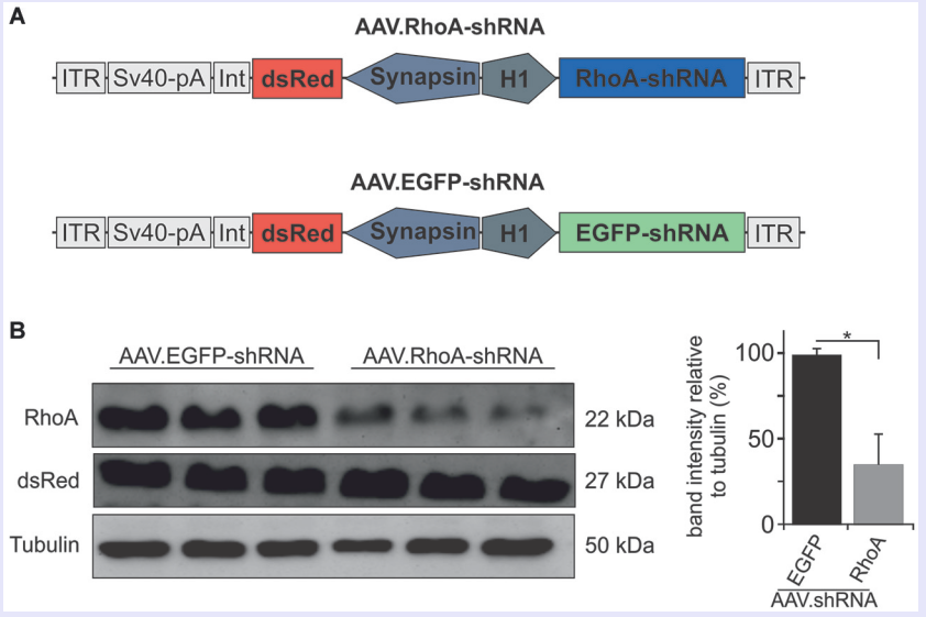 AAV 在眼科中应用研究-服务武汉枢密脑科学技术有限公司